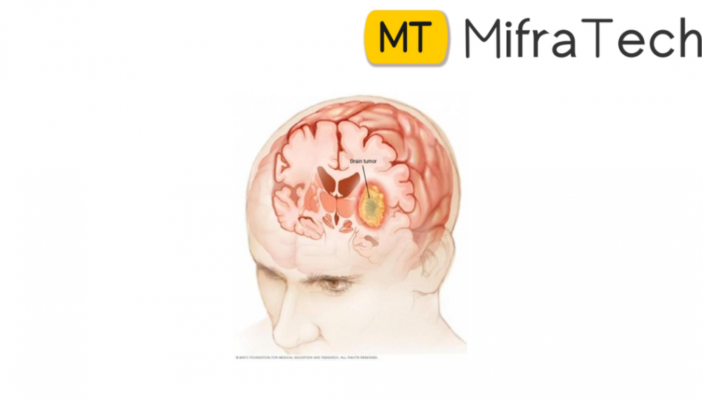 Brain tumour detection using deep learning and machine learning part -2